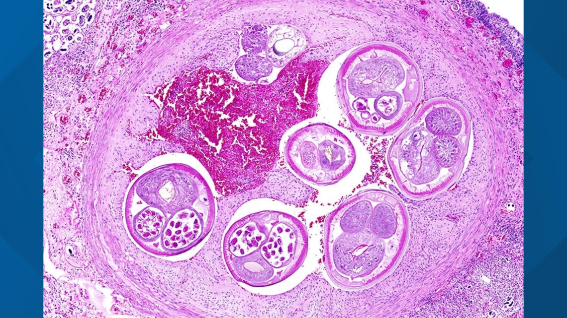 Brain-infecting worms, known as 'rat lungworm,' detected west of Texas ...