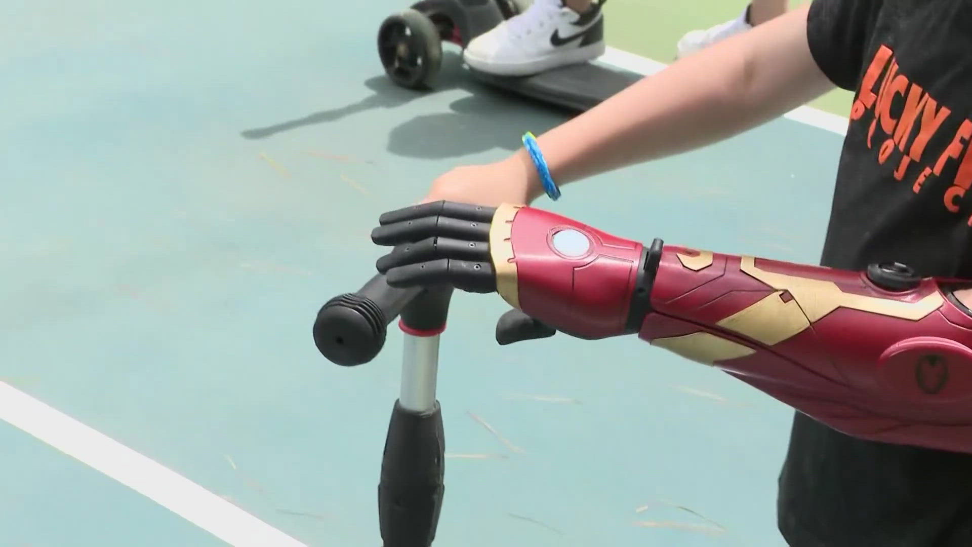 Meet the youngest recipient of a bionic arm | wusa9.com