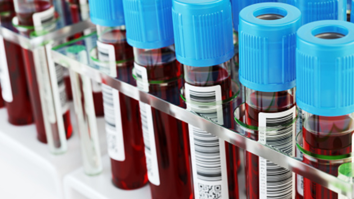 VERIFY: Can you take a blood test to check if you're vaccinated for the ...