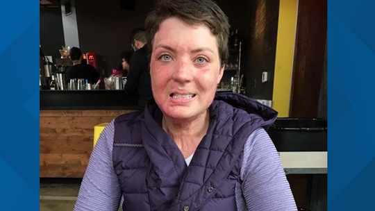 Capt. Katie Blanchard recovers after she was set on fire and stabbed ...