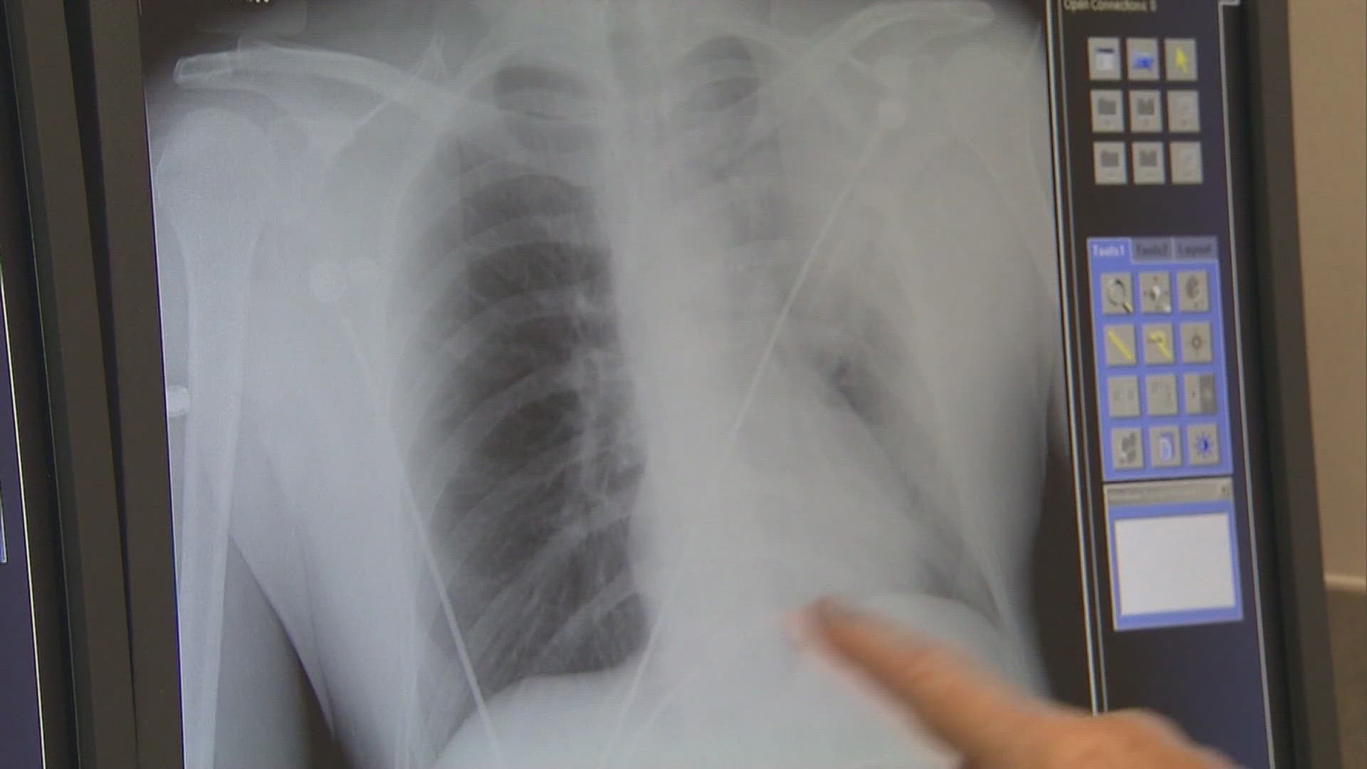 Study shows smoking and vaping carry same risk | wusa9.com