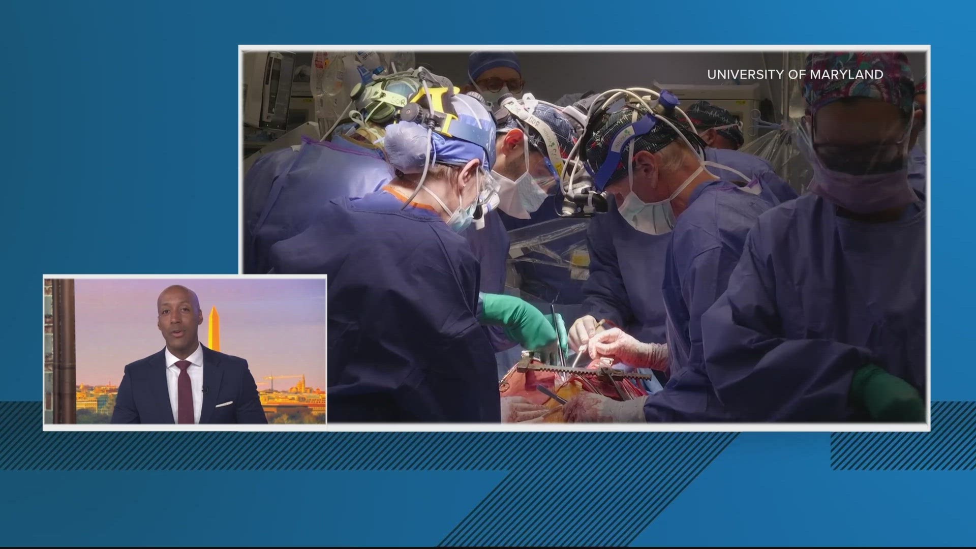 Surgeons perform second pig heart transplant | wusa9.com