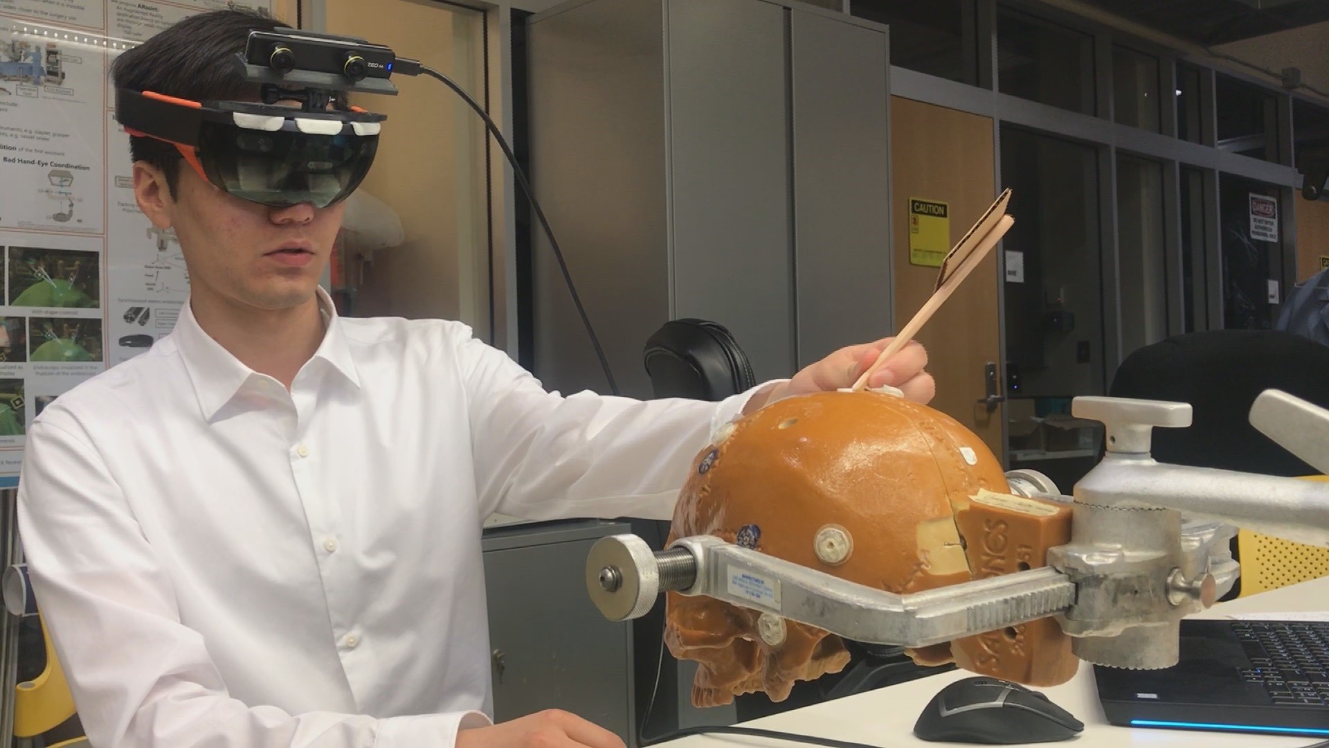 Virtual reality platform helps with brain surgery | wusa9.com