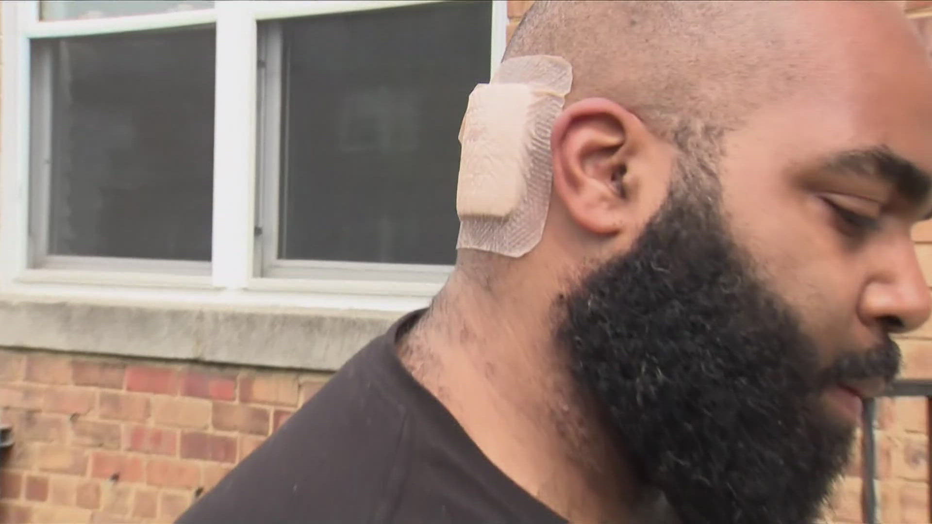 6 recovering after stabbing spree in Northeast DC; suspect identified ...