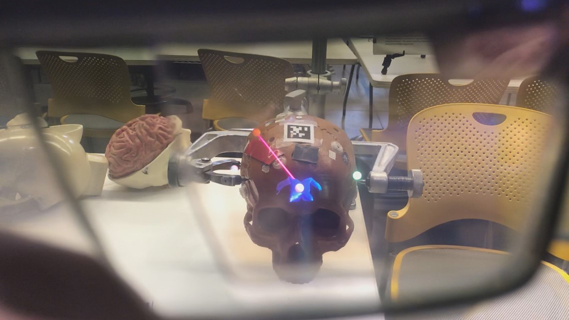 Virtual reality platform helps with brain surgery | wusa9.com