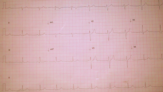 AI heart scan could save American lives | wusa9.com