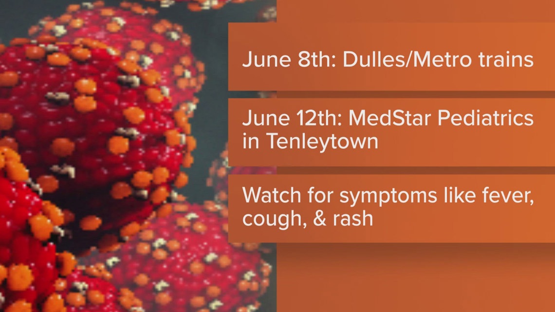 Confirmed case of measles in DC traveled through Dulles | wusa9.com