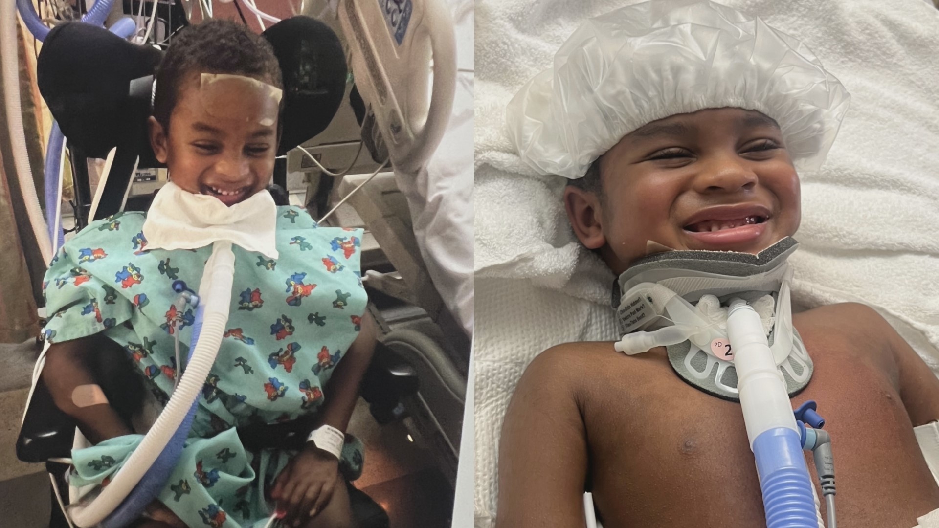 5-year-old partially paralyzed after being hit by drunk driver | wusa9.com