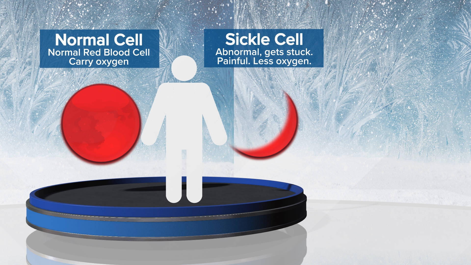 Windy days increase pain risk for sickle cell patients | wusa9.com