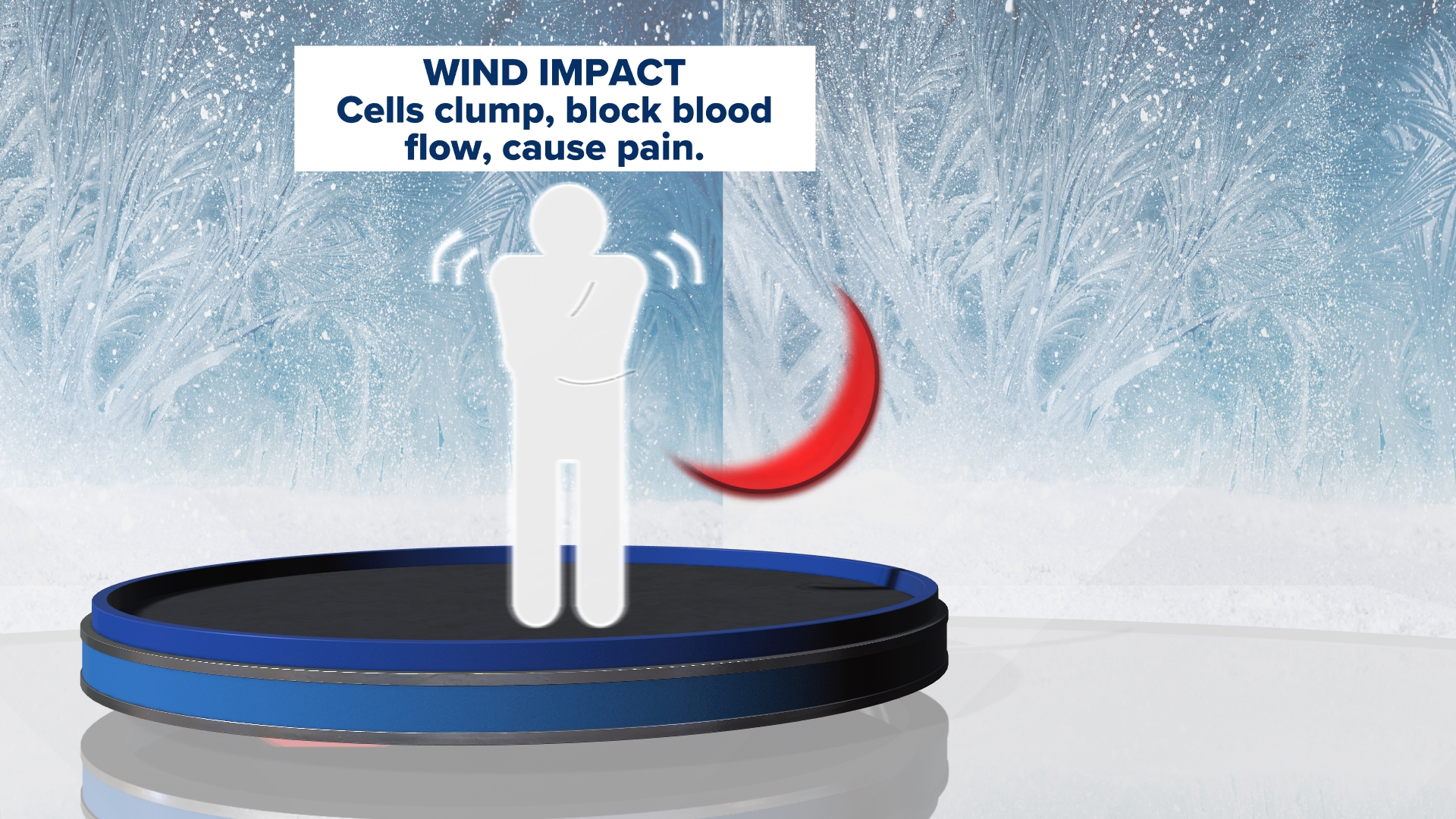 Windy days increase pain risk for sickle cell patients | wusa9.com