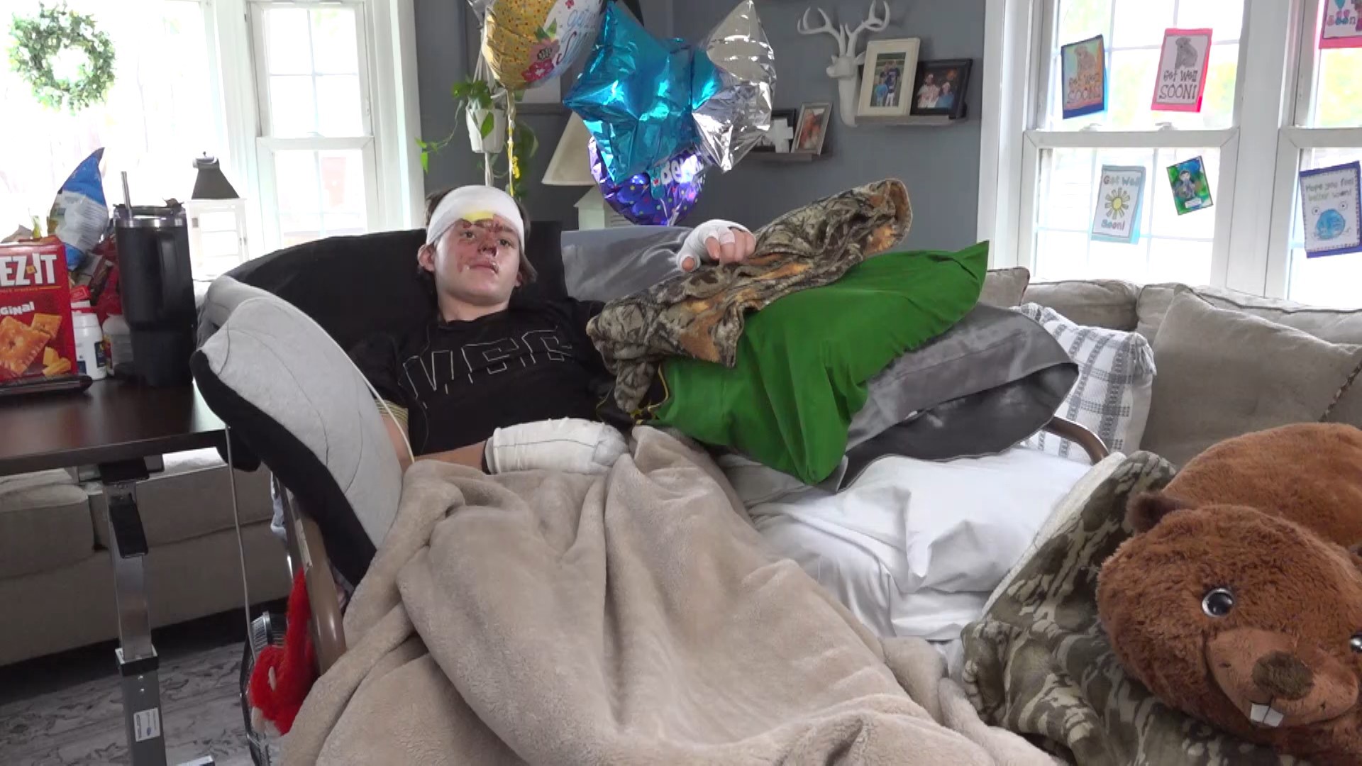 Prince William County teen badly burned while saving family from fire ...