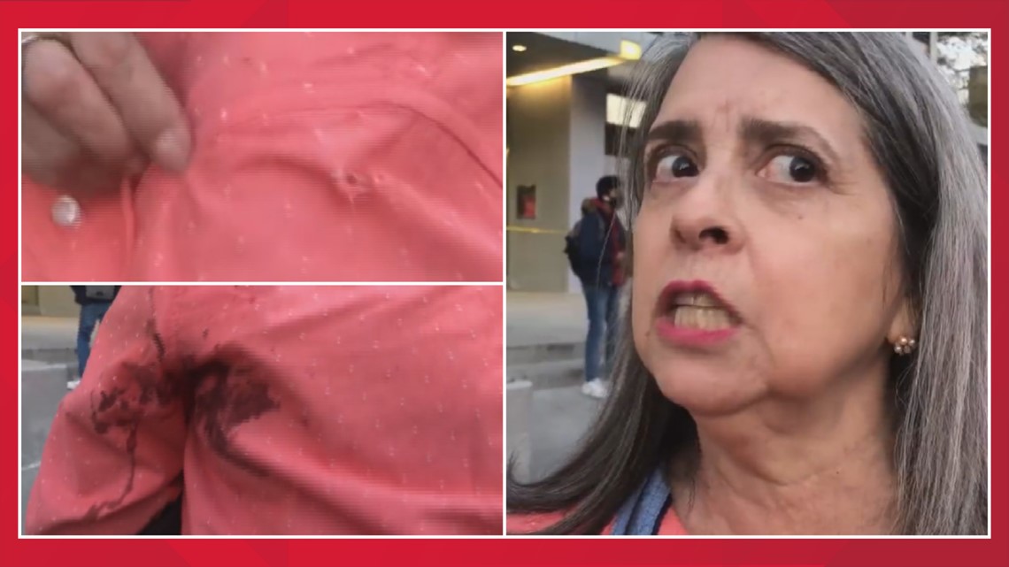 Woman speaks out after she was shot in Northwest DC: ‘It was so loud it ...